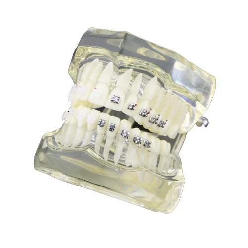 Ortho Half Metal/ Half Ceramic Ortho Half Metal/ Half Ceramic